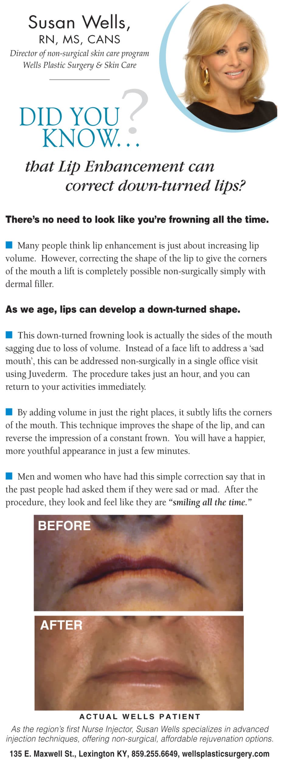 Did you know? - Wells Plastic Surgery and Skin Care